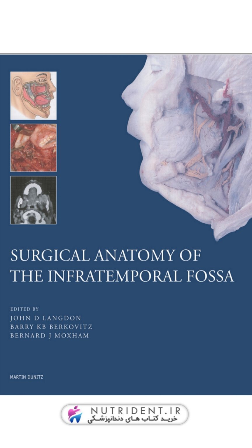 Surgical Anatomy of the Infratemporal Fossa - نوتریدنت
